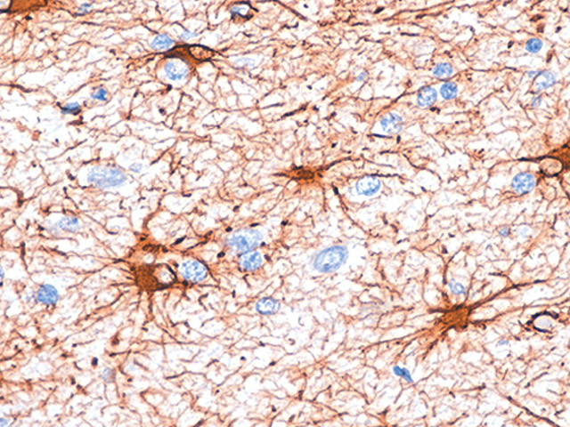 GATA-3 Antibody - Biocare Medical