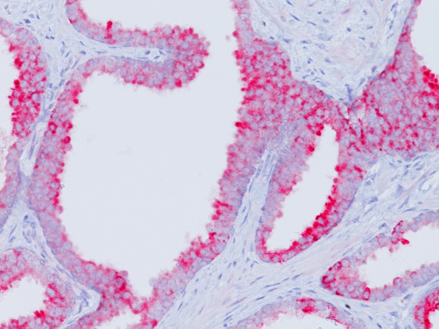 P504S Antibody - Biocare Medical