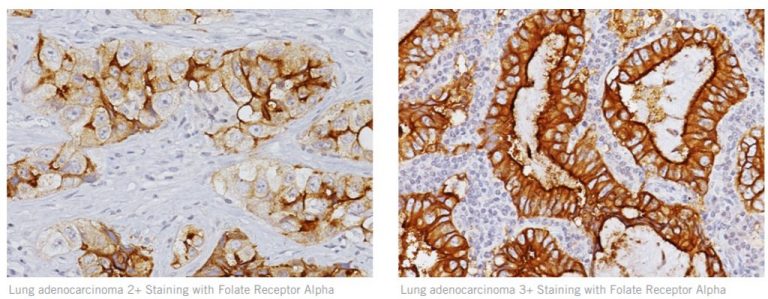 Harnessing the Power of Folate Receptor Alpha for Anti-Cancer Therapies ...