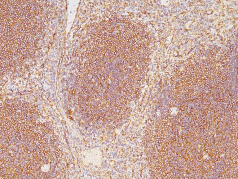 HLA-B [BC43] - Biocare Medical