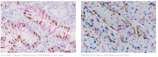 Maximize Your Research Through Multiplexing Technology - Biocare Medical