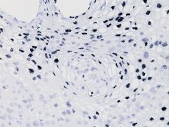 ISH HPV Probes | HPV Detection Using ISH | Biocare Medical