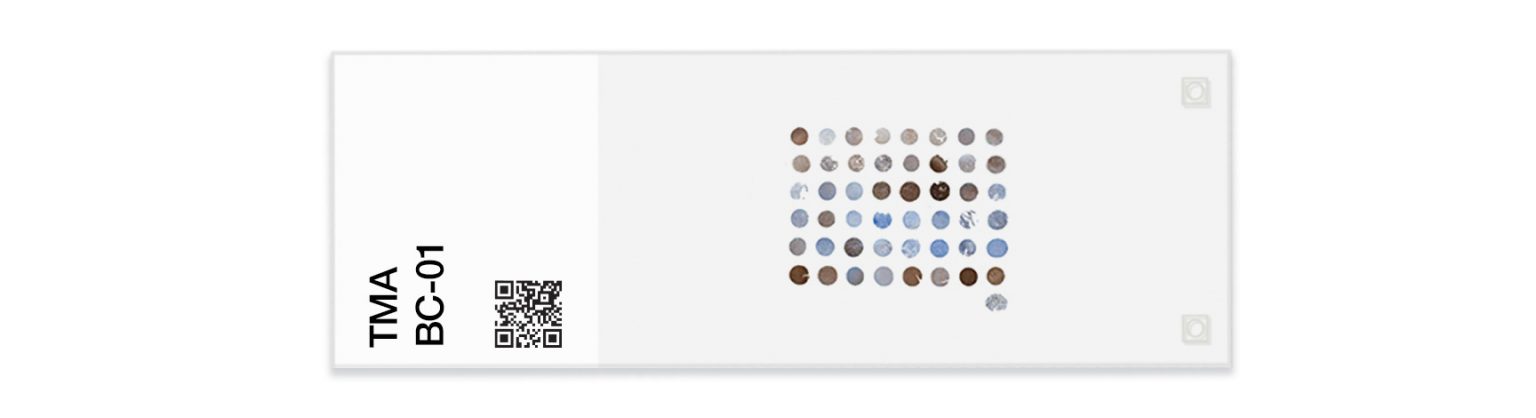 The Benefits of Using Tissue Microarrays (TMAs) In Your Lab - Biocare ...